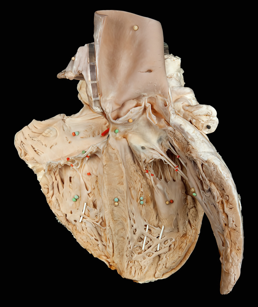 Dem-154 – Anatomionline.dk