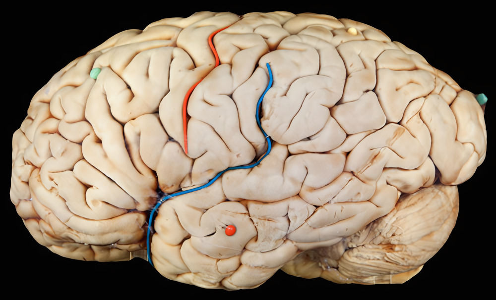 Dem-169 – Anatomionline.dk