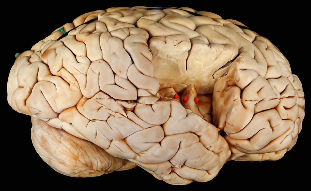 Dem-169 – Anatomionline.dk