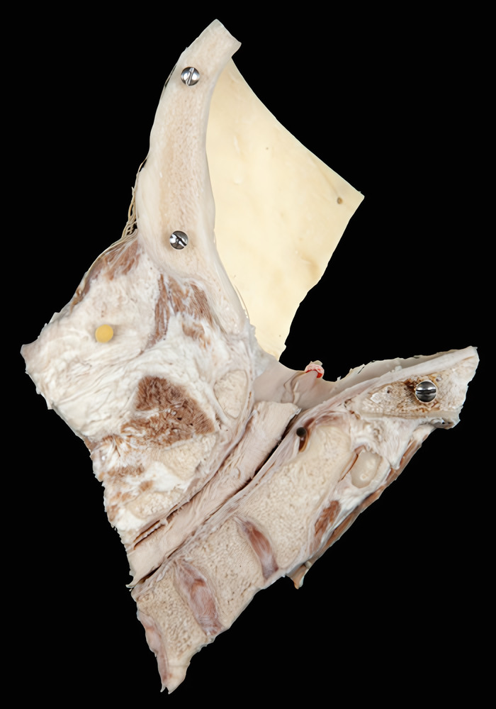 Dem-29 – Anatomionline.dk