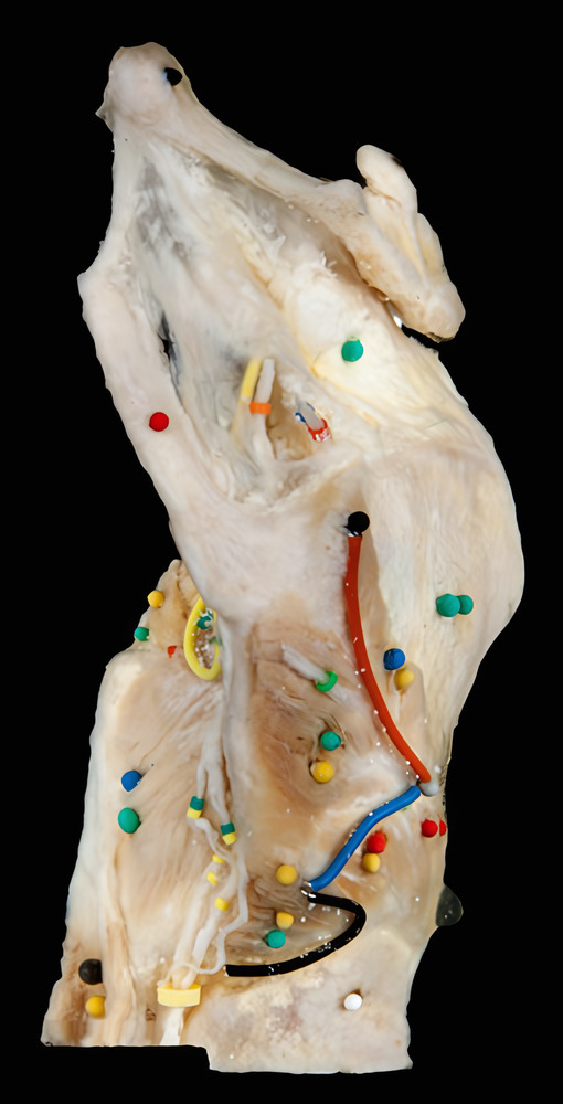 Dem-78 – Anatomionline.dk