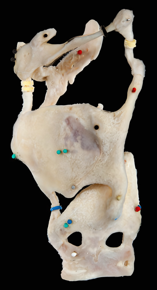 Dem-81 | Anatomionline.dk