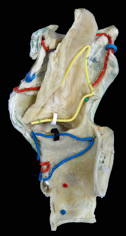 Dem-85 – Anatomionline.dk