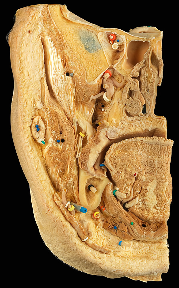 Aa-2-108 – Anatomionline.dk