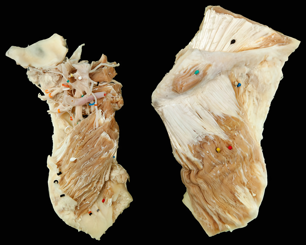 Aa-2-157 – Anatomionline.dk