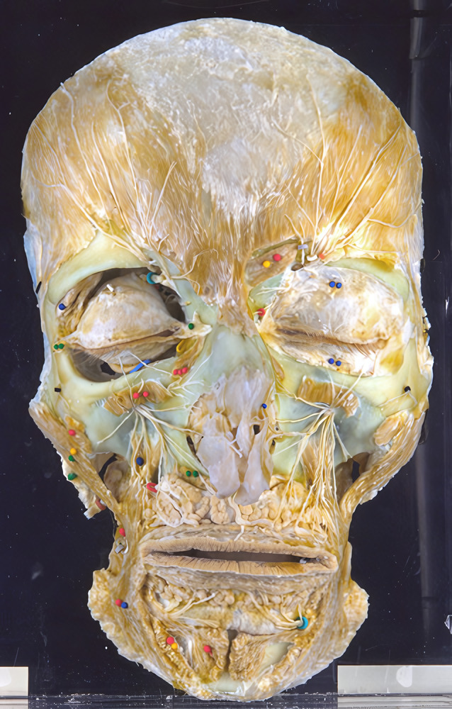 Aa-2-26 | Anatomionline.dk