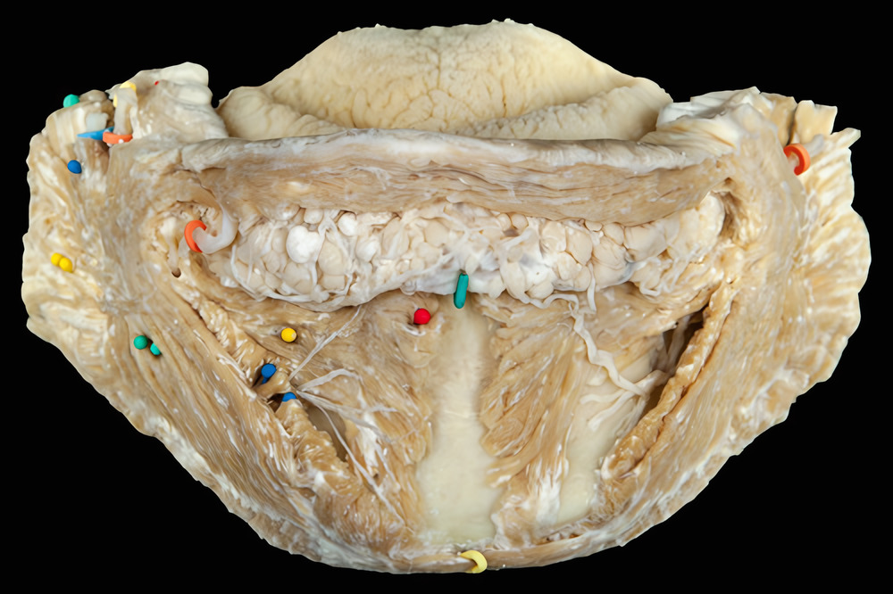 Aa-2-38 – Anatomionline.dk