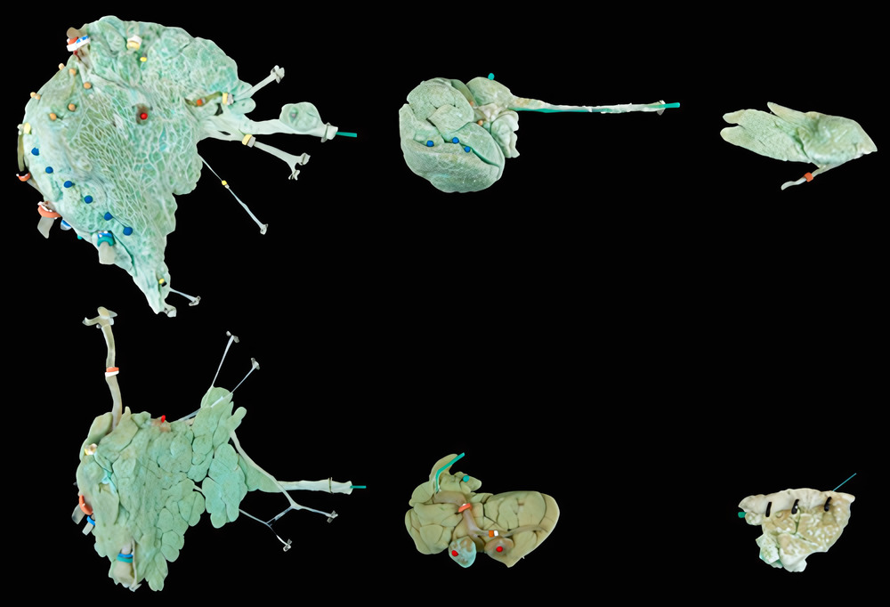 Aa-2-52 – Anatomionline.dk