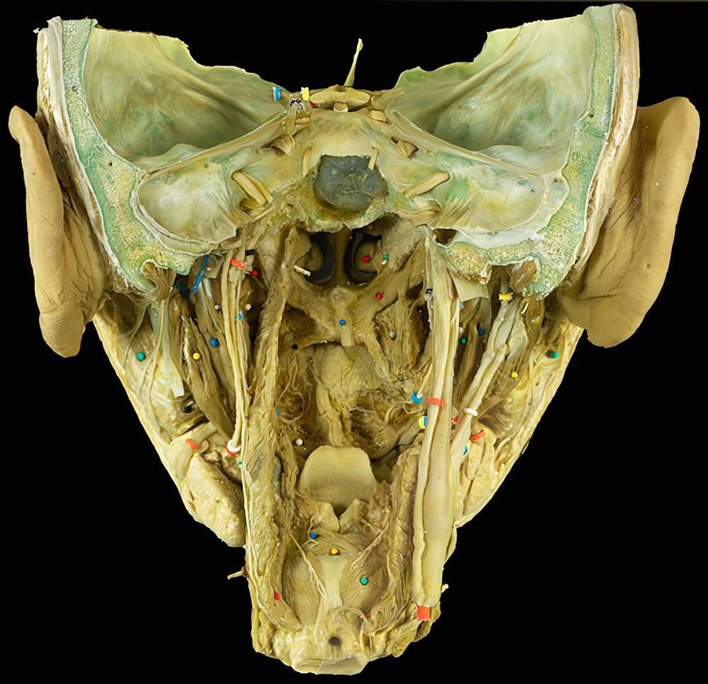 Aa-2-81 – Anatomionline.dk