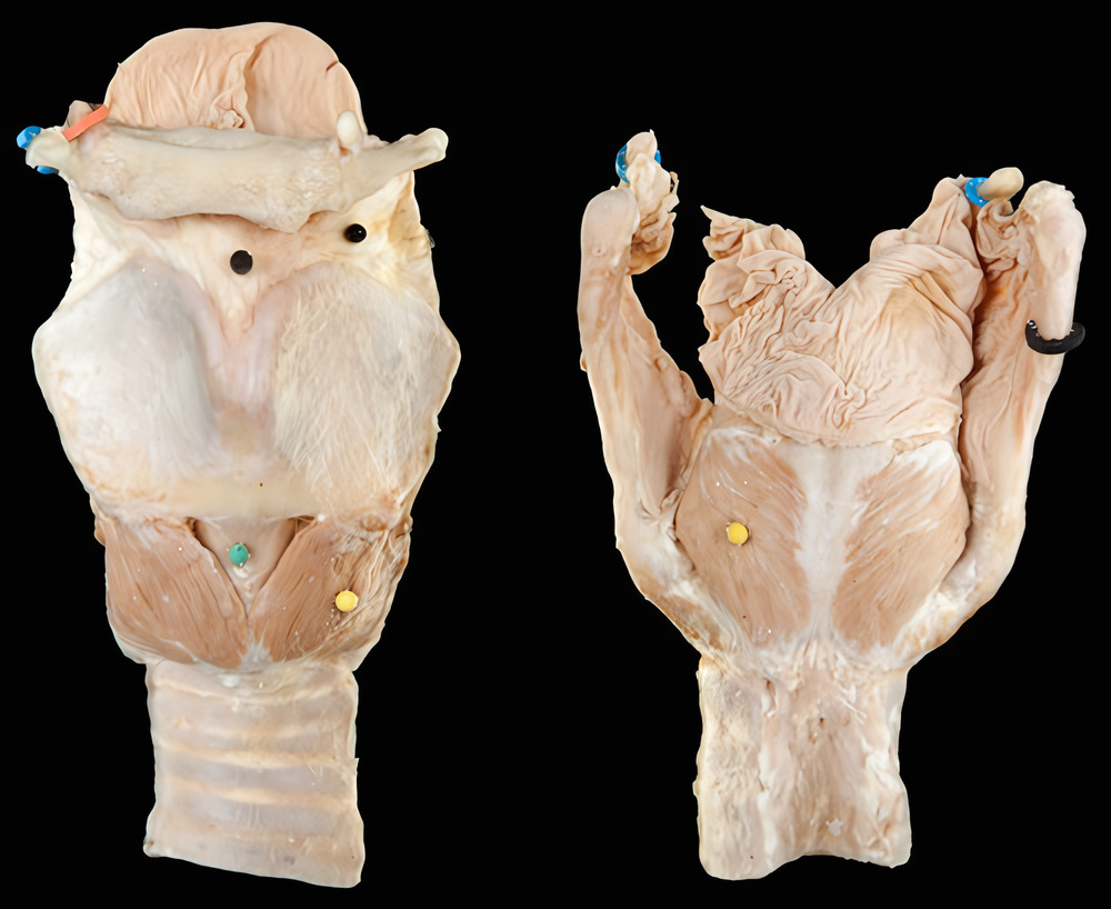 Ab-1-26 – Anatomionline.dk