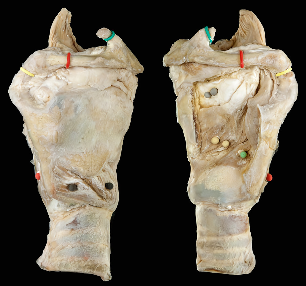 Ab-1-27 – Anatomionline.dk