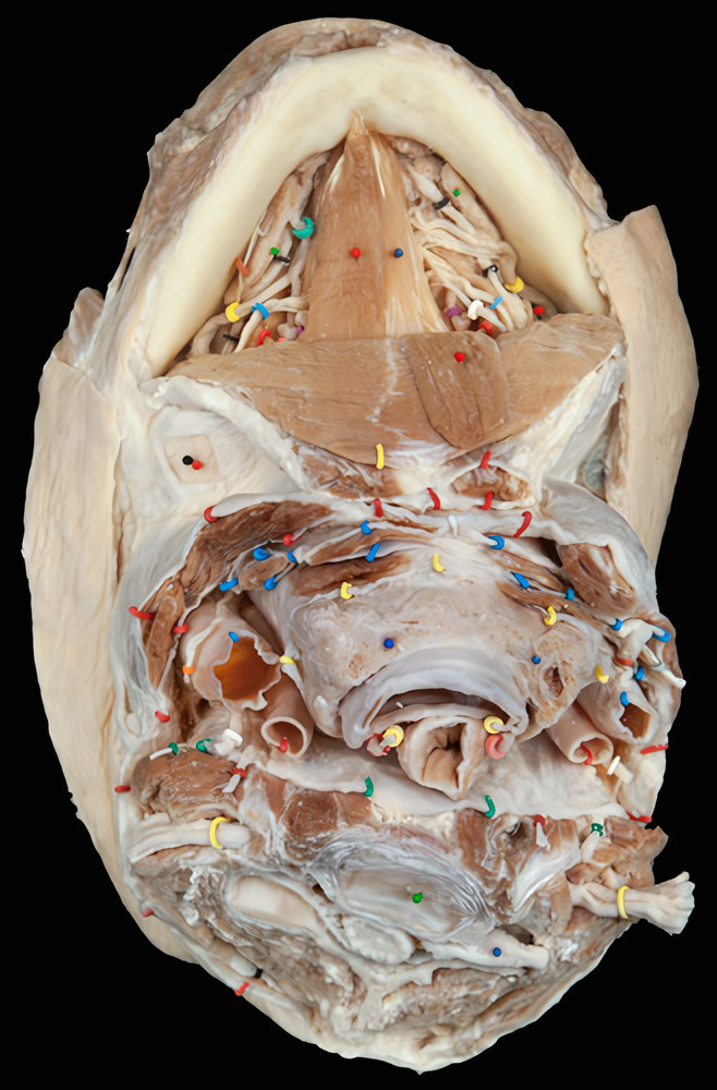 Ab-1-43 – Anatomionline.dk