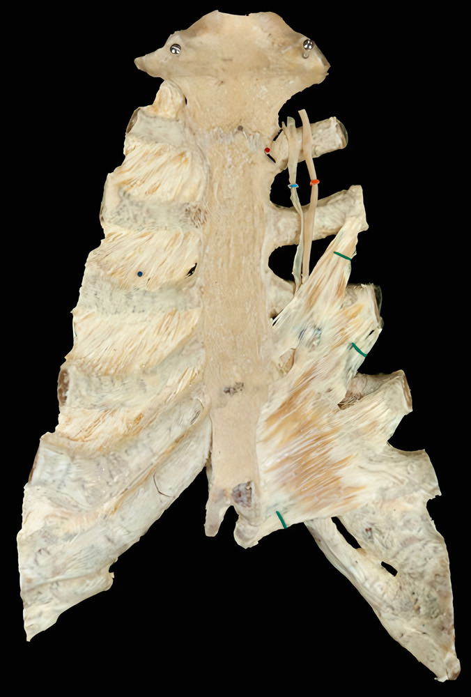 Ab-1-49 – Anatomionline.dk