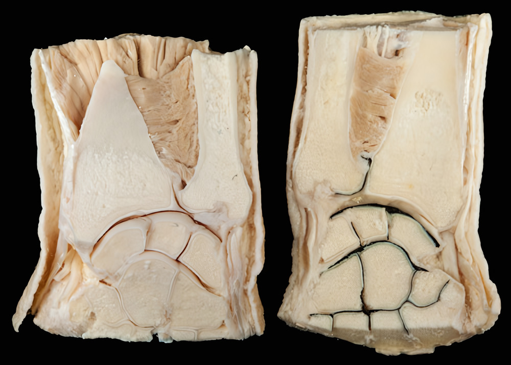 Ab-1-62 – Anatomionline.dk