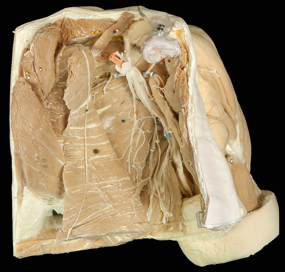 Ab-1-66 – Anatomionline.dk