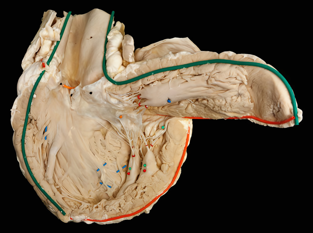 Ab-1-69 – Anatomionline.dk