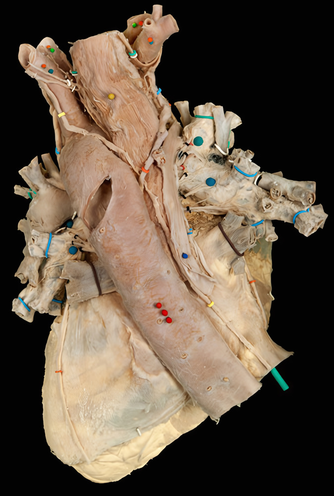 Ab-1-70 – Anatomionline.dk