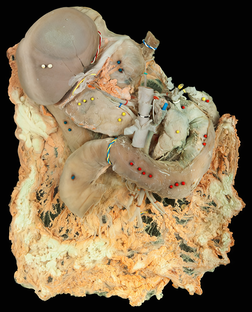 Ab-2-12 – Anatomionline.dk