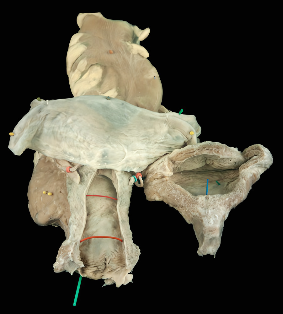 Ab-2-3 – Anatomionline.dk