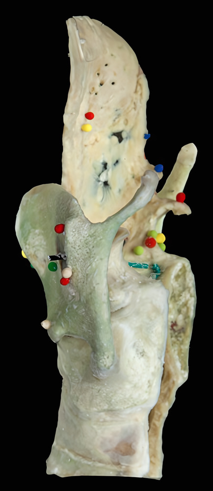 Dem-50 – Anatomionline.dk