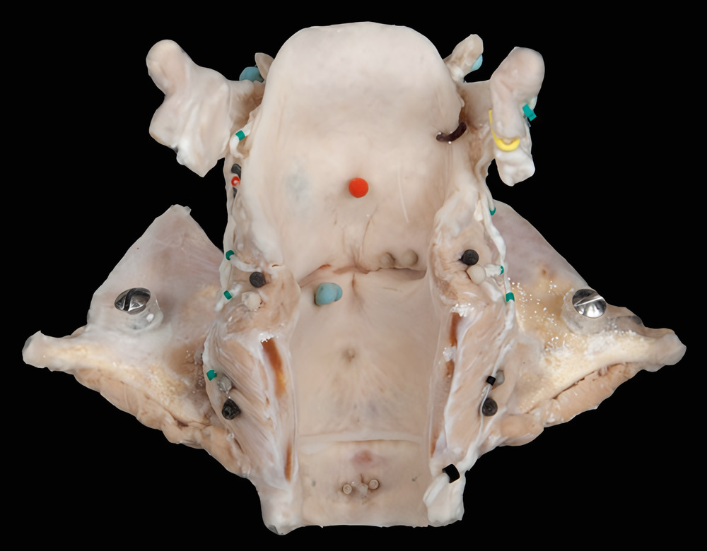 Dem-58 – Anatomionline.dk