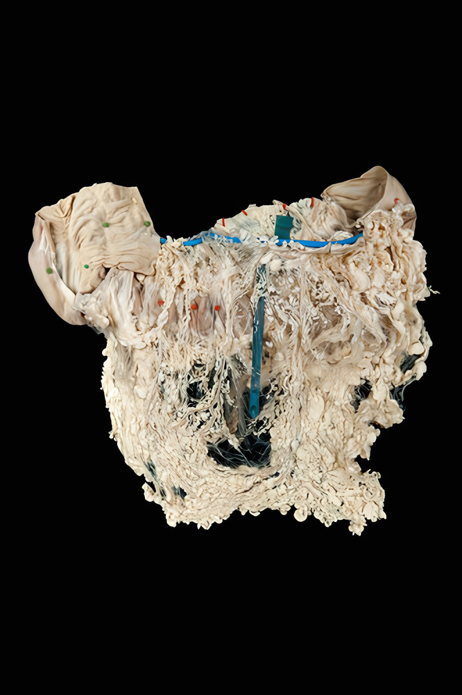 Dem-93 – Anatomionline.dk