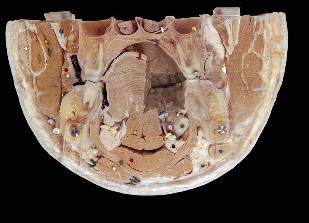 Aa-1-64 – Anatomionline.dk